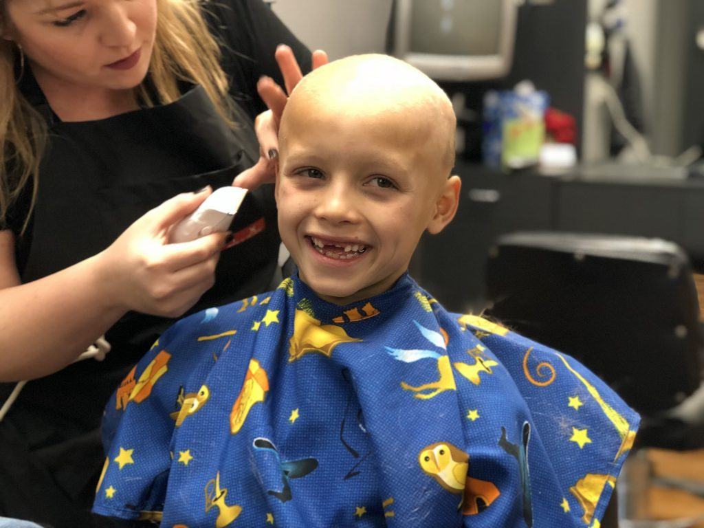 Why My Son is Bald | 6 Weeks with Alopecia Areata – | Baby Gizmo