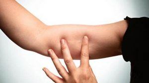 Nexplanon: The Birth Control Implanted In My Arm – | Baby Gizmo